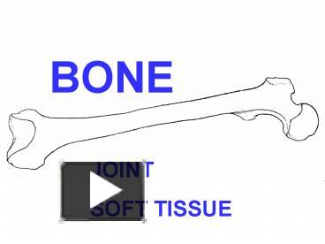 BONE presentation | free to view