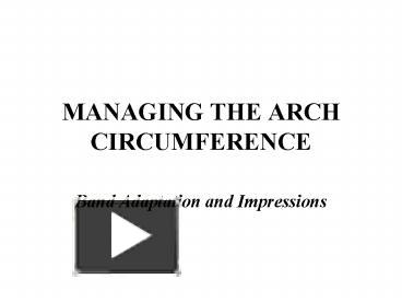 PPT – MANAGING THE ARCH CIRCUMFERENCE PowerPoint presentation | free to ...