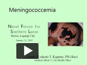 Meningococcemia presentation | free to download