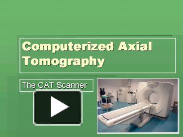 Computerized Axial Tomography presentation | free to view