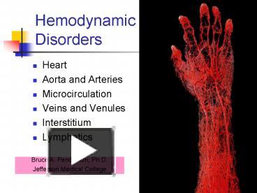 PPT – Hemodynamic Disorders PowerPoint presentation | free to download ...