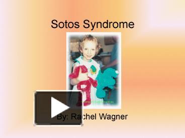 Sotos Syndrome presentation | free to view