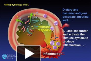 Pathophysiology of IBD pt' 2 presentation | free to view