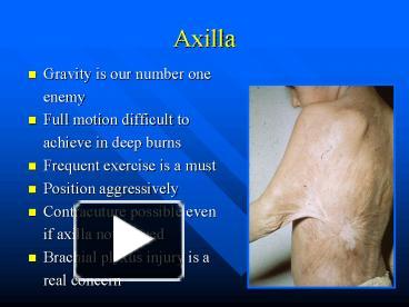 PPT – Axilla PowerPoint presentation | free to view - id: 15c909-ZDc1Z