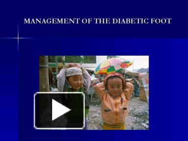 MANAGEMENT OF THE DIABETIC FOOT presentation | free to view