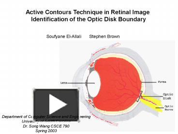 Active Contours Technique in Retinal Image presentation | free to download