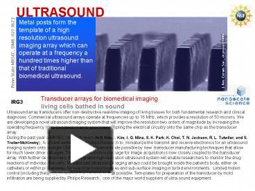 ULTRASOUND presentation | free to download