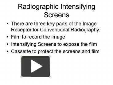Radiographic Intensifying Screens presentation | free to view