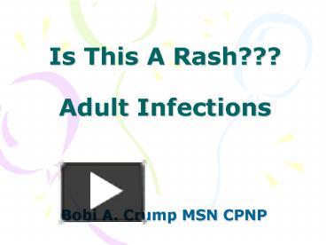 PPT – Is This A Rash Adult Infections PowerPoint presentation | free to ...