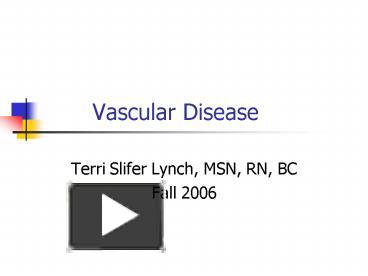 PPT – Vascular Disease PowerPoint presentation | free to view - id ...