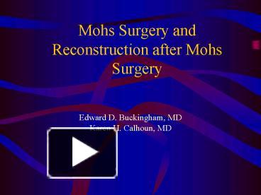 Mohs Surgery and Reconstruction after Mohs Surgery presentation | free ...