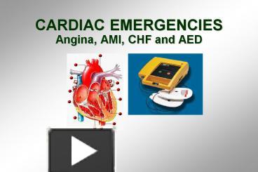 PPT – CARDIAC EMERGENCIES Angina, AMI, CHF and AED PowerPoint ...