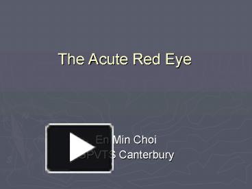 The Acute Red Eye presentation | free to view