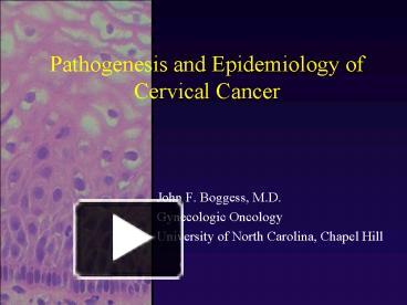 Pathogenesis and Epidemiology of Cervical Cancer presentation | free to ...