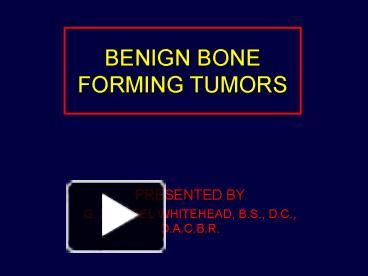 PPT – BENIGN BONE FORMING TUMORS PowerPoint presentation | free to view ...