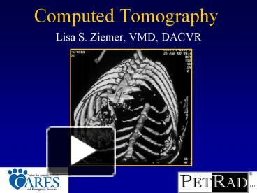 Computed Tomography presentation | free to view