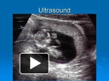 Ultrasound presentation | free to view