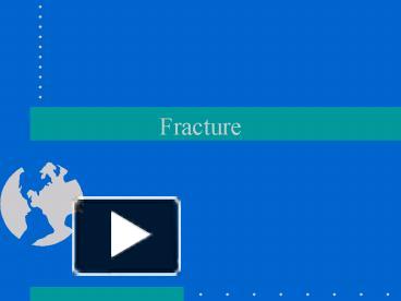 PPT – Fracture PowerPoint presentation | free to view - id: 1ae4d7-ZjY5Y