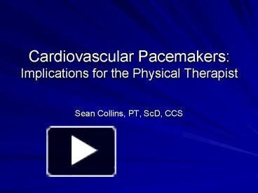 PPT – Cardiovascular Pacemakers: Implications for the Physical ...