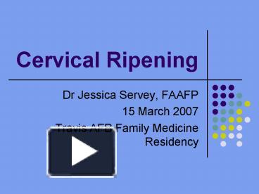 Cervical Ripening presentation | free to view