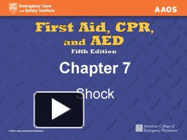 PPT – Shock PowerPoint presentation | free to download - id: 1b2738-ZDc1Z