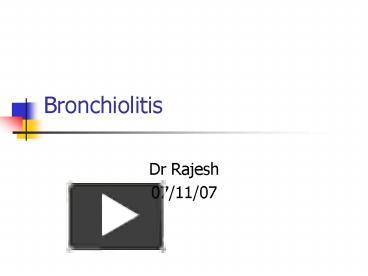 Bronchiolitis presentation | free to view