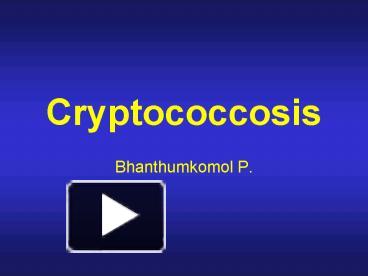 Cryptococcosis presentation | free to view