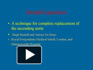 Bentall operation presentation | free to view