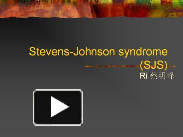 Stevens-Johnson syndrome (SJS) presentation | free to view