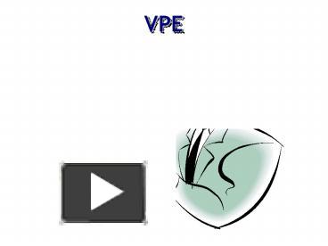 VPE presentation | free to view