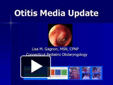 Otitis Media Update presentation | free to view