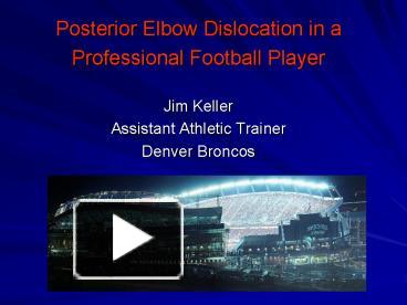 PPT – Posterior Elbow Dislocation in a PowerPoint presentation | free ...