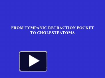 FROM TYMPANIC RETRACTION POCKET TO CHOLESTEATOMA presentation | free to ...