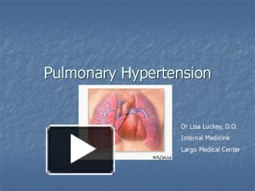 Pulmonary Hypertension presentation | free to view