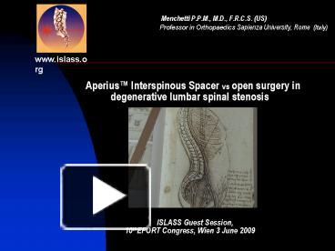 Aperius Interspinous Spacer vs open surgery in degenerative lumbar ...