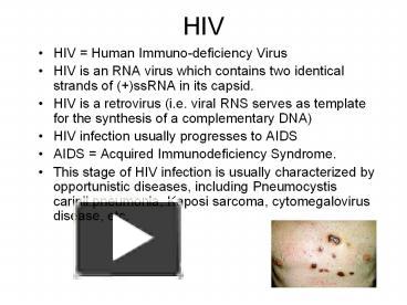 PPT – HIV PowerPoint presentation | free to download - id: 1c6dfa-ZDc1Z