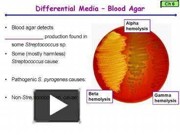 Differential Media Blood Agar presentation | free to view