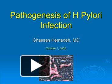 Pathogenesis of H Pylori Infection presentation | free to view