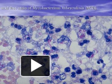 acid fast stain of Mycobacterium tuberculosis MTB' presentation | free ...