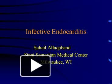 PPT – Infective Endocarditis PowerPoint presentation | free to view ...