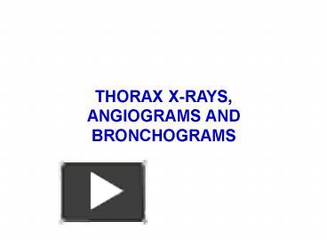 PPT – THORAX X-RAYS, ANGIOGRAMS AND BRONCHOGRAMS PowerPoint ...
