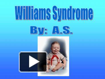 Williams Syndrome presentation | free to view