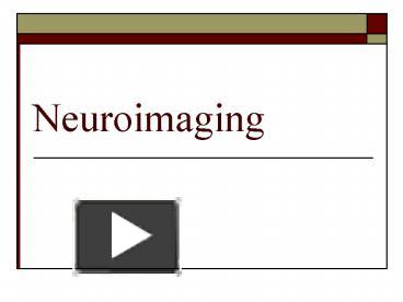 Neuroimaging presentation | free to view