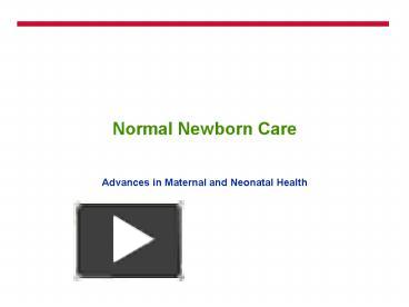 Normal Newborn Care presentation | free to view