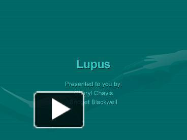 PPT – Lupus PowerPoint presentation | free to view - id: 1e99ac-ZDc1Z