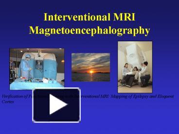 PPT – Interventional MRI Magnetoencephalography PowerPoint presentation ...