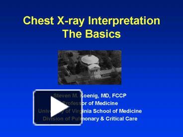 Chest Xray Interpretation The Basics presentation | free to view