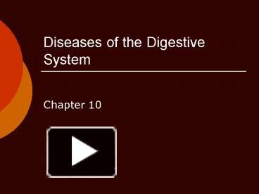 PPT – Diseases of the Digestive System PowerPoint presentation | free ...