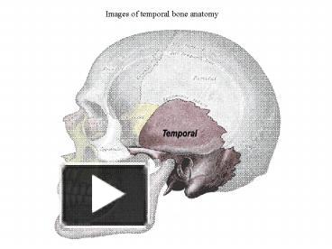 Images of temporal bone anatomy presentation | free to view