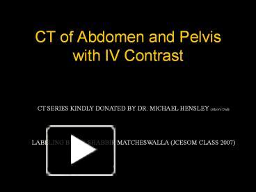 CT of Abdomen and Pelvis with IV Contrast presentation | free to view